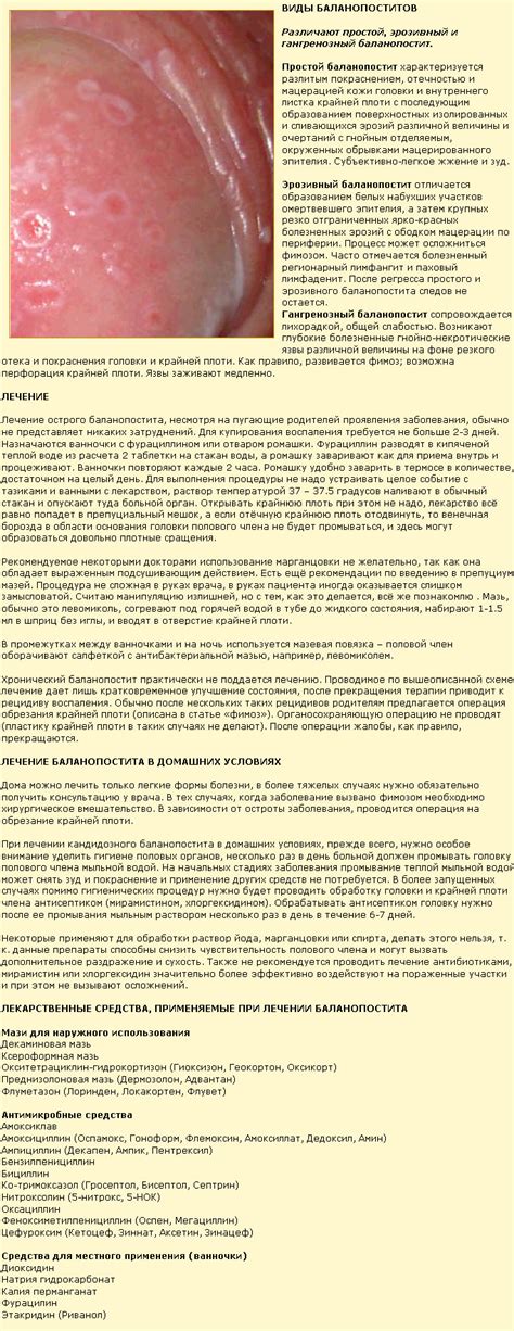 Баланит Фото Лечение — Фото Картинки
