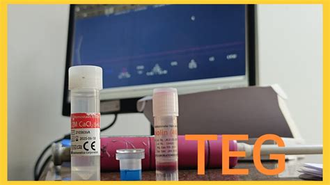 How To Do Teg Blood Test Thrombo Elastro Graphy Teg Hemostasis Ot Technician Ot Youtube