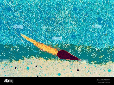 False Colour Transmission Electron Micrograph Tem Showing Penetration Of An Ovum By A Single