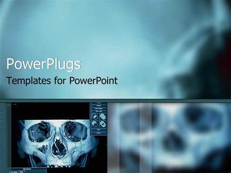 Radiology Powerpoint Template