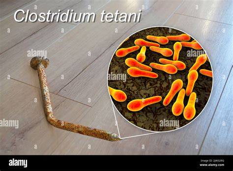 Tetanus Transmission