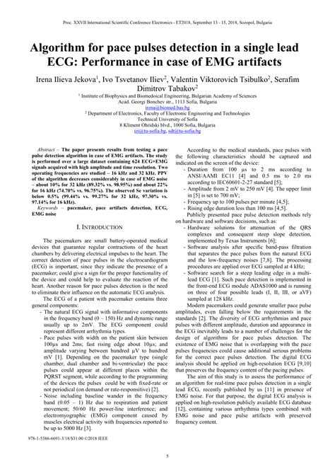pdf algorithm for pace pulses detection in a single lead ecg
