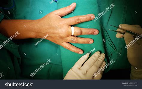 Trigger Finger Operation Royalty Free Images Stock Photos Pictures Shutterstock