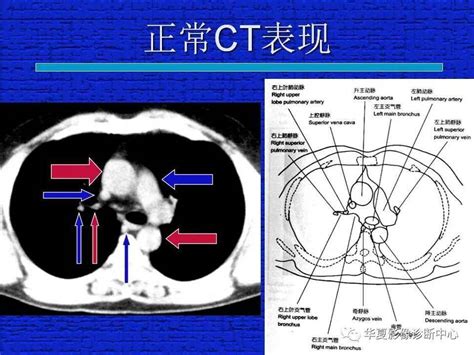 结合解剖谈正常胸部ct读片 搜狐大视野 搜狐新闻