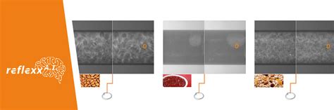 The Future Of Intelligent Foreign Object Detection