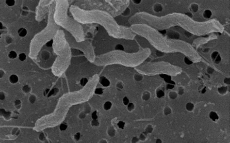 Campylobacter Jejuni Specific Antibody Gives Hope To Vaccine Development Healthcare Hygiene