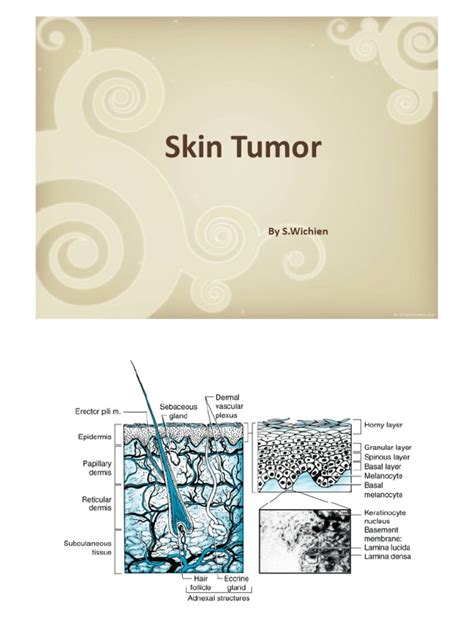 Pdf Microsoft Power Point Skin Tumor [compatibility Mode] Dokumen