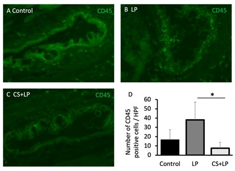 Conjunctival Cd45 Immunohistochemistry Staining And Cd45 Positive