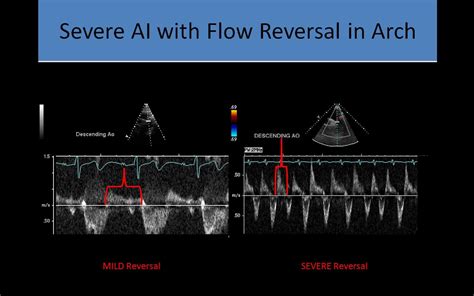 Ultrasound Registry Review Valvular Abnormalities
