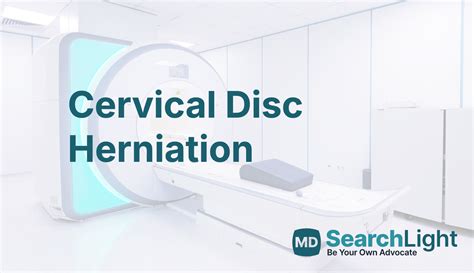 Cervical Disc Herniation Md Searchlight
