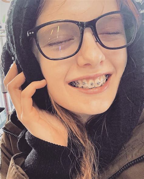 Braces Girlswithbraces Metalbraces Glasses Glassesandbraces Girlswithglasses Braces Girls