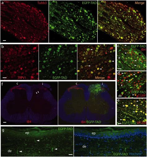 Primary Sensory Neuron Specific Interference Of Trpv1 Signaling By Aav Encoded Trpv1 Peptide