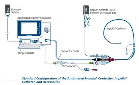 How An Impella Works At Lara Tolmie Blog