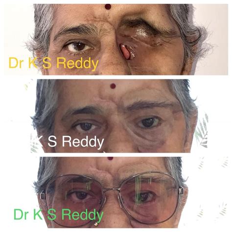 Dr Sanketh Kethireddy On Linkedin Finally Happy Orbit