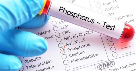Phosphorus Labcorp Test Code At Edward Gratwick Blog