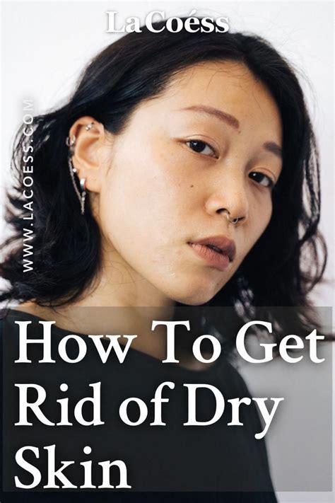 40 Best Ways To Get Rid Of A Acne Scabs Overnight Artofit