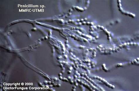Penicillium Species Doctor Fungus