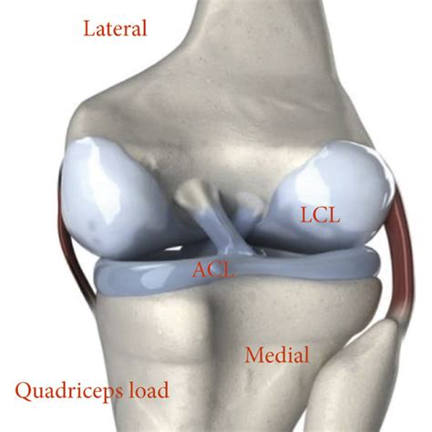 Three Dimensional Finite Element Model Of Knee Joint Femur Tibia Download Scientific Diagram