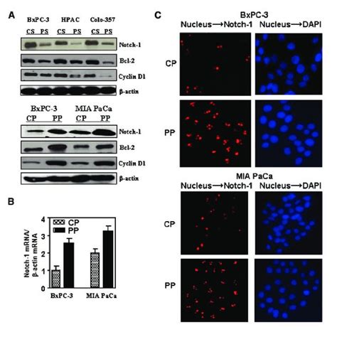 Immunohistochemical Expression Of Pdgf D In Pancreatic Cancer Tissue