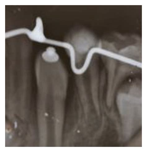 A At The Fourth Month A Surgical Excision Was Performed And The Download Scientific Diagram