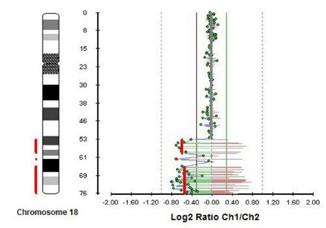 Array Cgh Analysis Of Chromosome Using A 4400 Bac Clone Micro Array