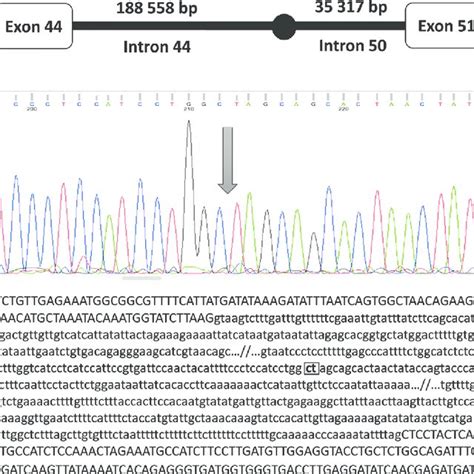 The Dmd Exon 45 50 Deletion Breakpoint Determined By Sanger Sequencing Download Scientific