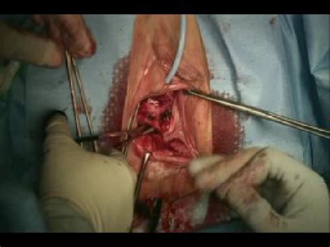 Obstetrics Gynecology