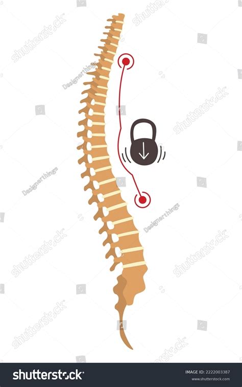 Spinal Deformity Symbol Spine Curvatures Unhealthy стоковая векторная графика без лицензионных