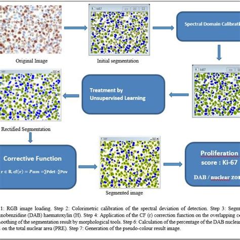 The Diagram Of The Procedure Of Automated Quantitative Analysis Of The