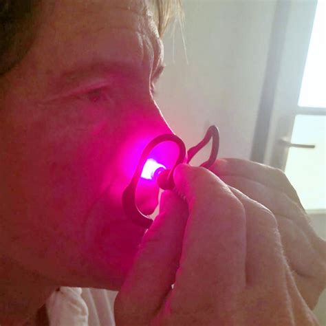 Spectrum Laser For Tinnitus Hearing Loss Hyperacusis And Dizziness