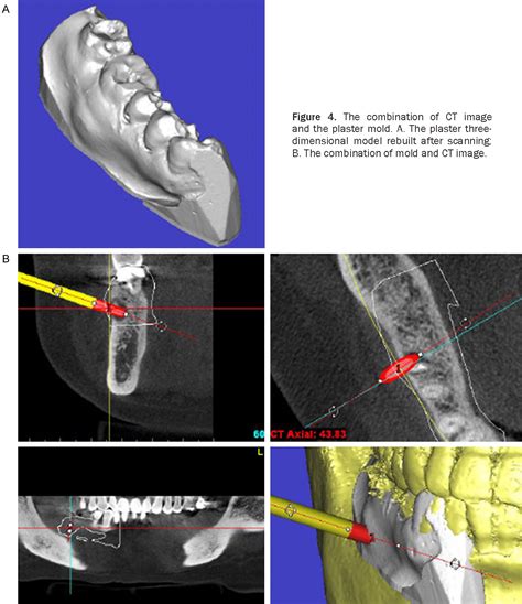 Apex Of Root Of Tooth Semantic Scholar