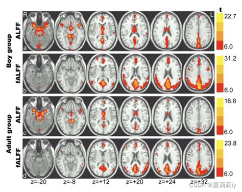 静息态功能磁共振成像 rs fMRI 原理与数据分析学习笔记1Resting State fMRI 静息态功能磁共振成像