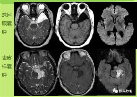Mri Dwi Adc