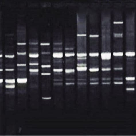 Inter Simple Sequence Repeat Issr Banding Profiles Obtained On 20 Download Scientific