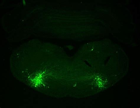 Novel Brainstem Circuit Gives Rise To The Rhythms Of Vocalization Uc