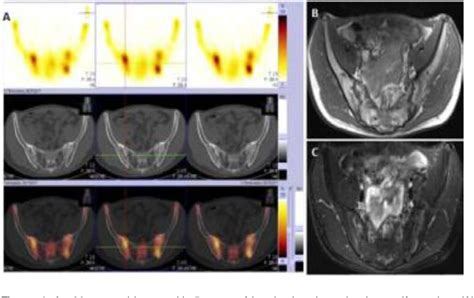 Table 1 From Bone Texture Analysis With Deep Learning In Hand