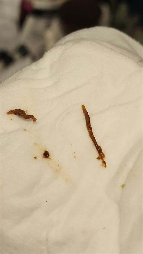 Please Are These Worms In Stool 🤢🤮😭 R Diagnoseme