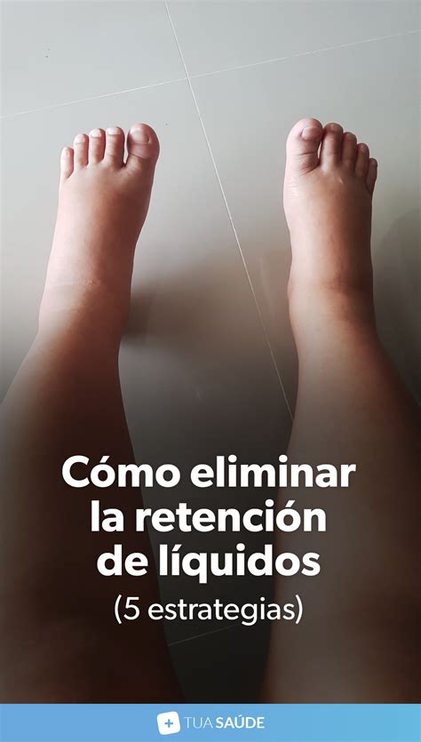 Retencion De Liquidos Artofit