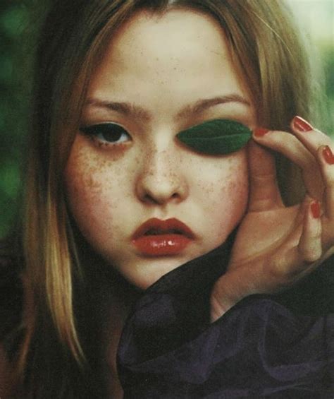 How Do Freckles Form Wander Lord