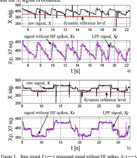 Figure 5 From A New Technique For Improving Pupil Detection Algorithm Semantic Scholar