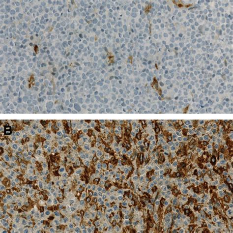 Fibronectin Staining Highlights Fibrous Strands Of The Ecm Between Download Scientific Diagram