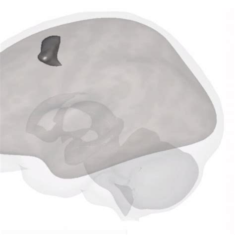 Dlpfc Regions That Presented A Significant Regional Cerebral Blood Flow