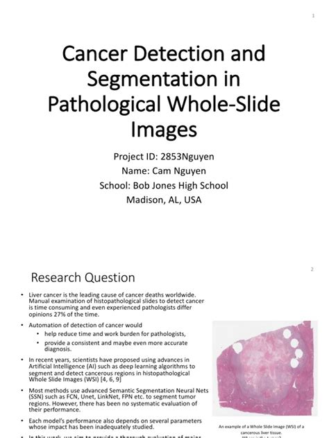 Cancer Detection And Segmentation Project Ppt Compressed Pdf Image