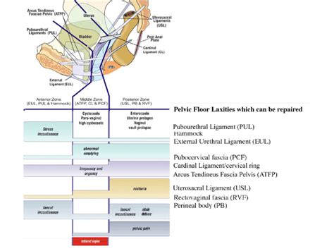 Pictorial Algorithm A Symptom Guide To Surgical Reconstruction Of The