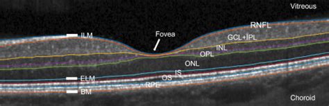 Eight Retinal Layers The Retinal Nerve Fiber Layer Rnfl The