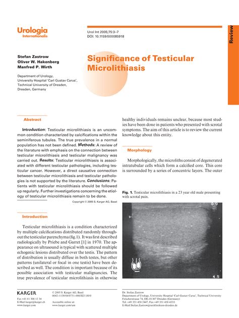 Significance Of Testicular Microlithiasis Docslib