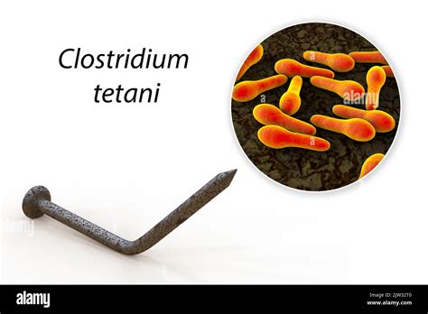 Cause Of Tetanus Hi Res Stock Photography And Images Alamy
