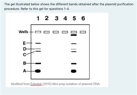 Solved The Gel Illustrated Below Shows The Different Bands