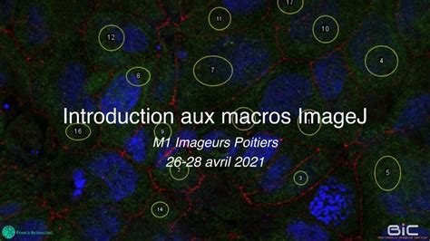 [2021 master1 gphy imageurs u poitiers] introduction aux macros imagej