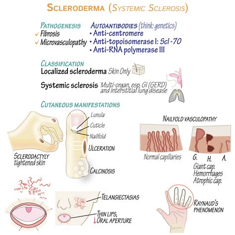 Scleroderma Clinical Pathology Flashcards Ditki Medical And